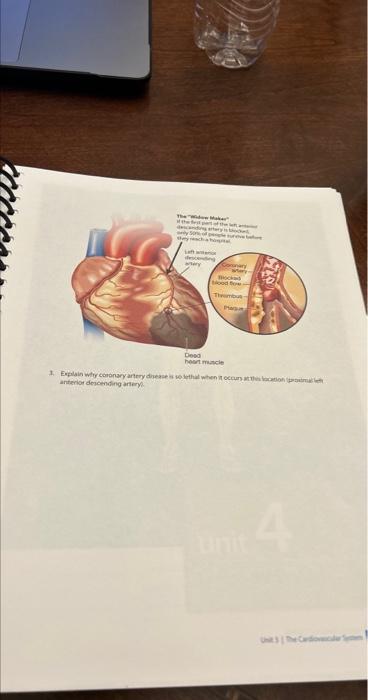 Solved anterior descending antery? | Chegg.com