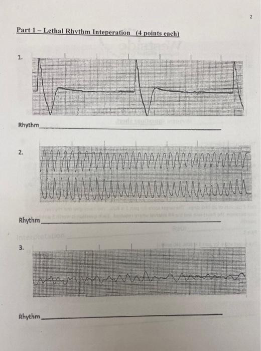 Solved 2 Part 1 - Lethal Rhythm Inteperation (4 points each) | Chegg.com