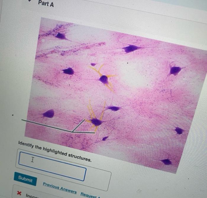 Solved PAL: Histology > Nervous Tissue > Lab Practical > | Chegg.com
