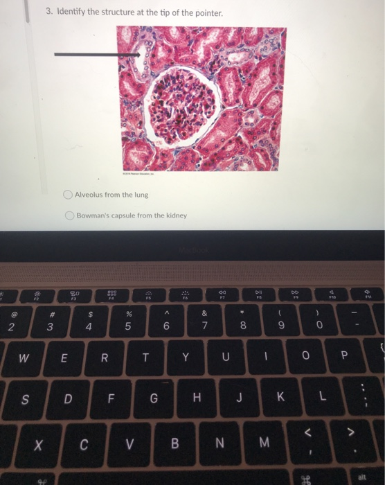 Solved 3. Identify the structure at the tip of the pointer. | Chegg.com