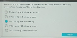 Solved Analyze ths DDD pocamaker strip kentify any | Chegg.com