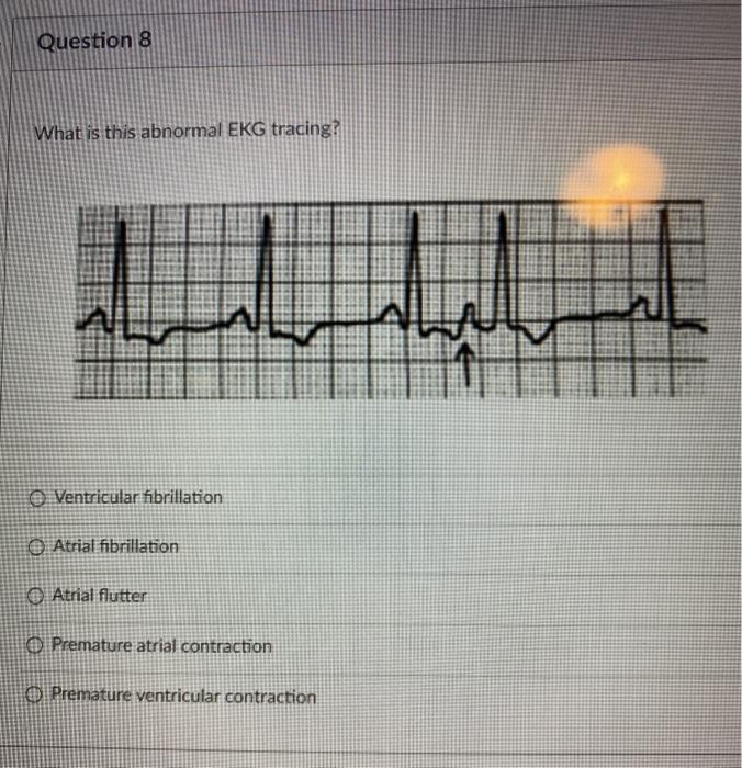 Solved Question 8 What is this abnormal EKG tracing? A AWN | Chegg.com