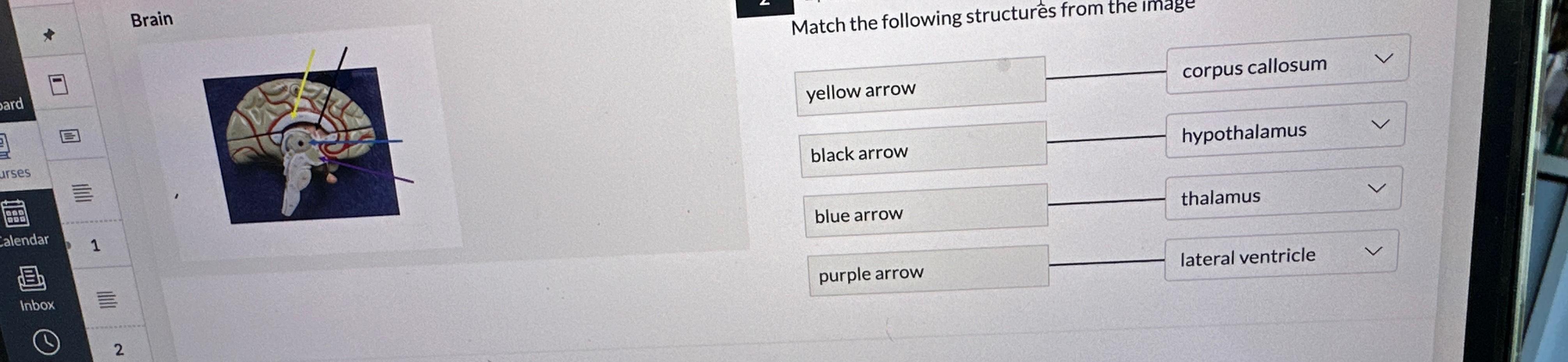 Solved BrainMatch the following structures from the | Chegg.com