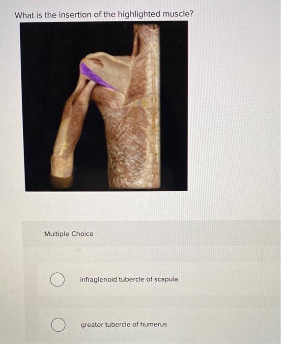 Solved What is the insertion of the highlighted muscle? | Chegg.com
