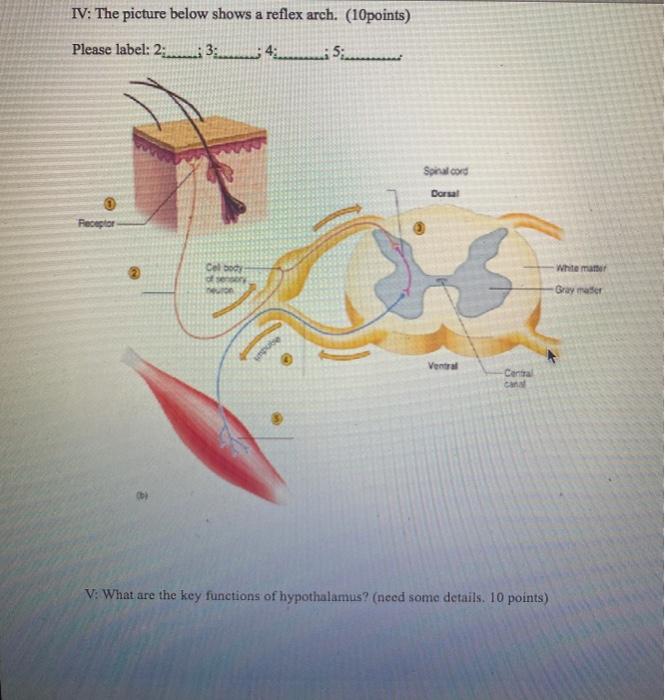 Solved IV: The picture below shows a reflex arch. (10points) | Chegg.com
