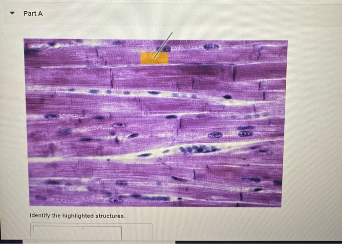 Solved Part A Identify the highlighted structure. perimesium | Chegg.com