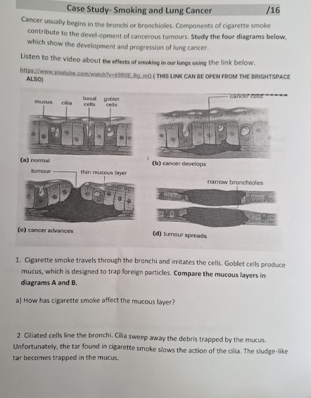 Solved Case Study-Smoking and Lung Cancer/16Cancer usually | Chegg.com