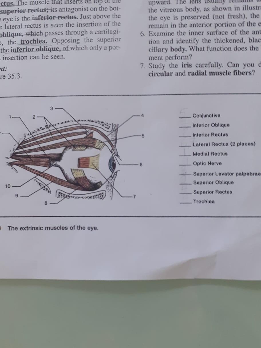 Solved Conjunctiva Inferior Oblique Interior Rectus Lateral | Chegg.com