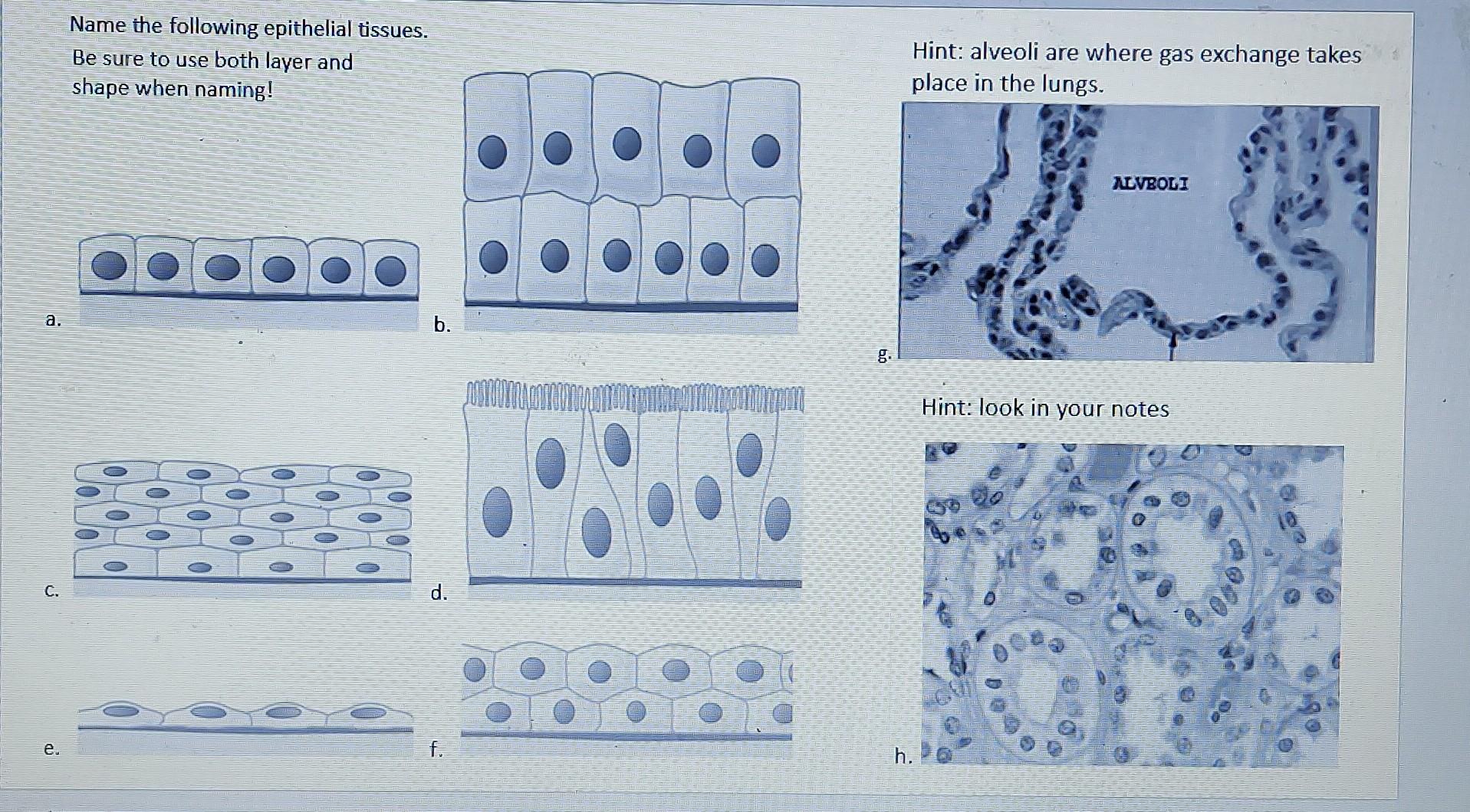 Solved Epithelial Tissue Word Bank Absorption Columnar | Chegg.com