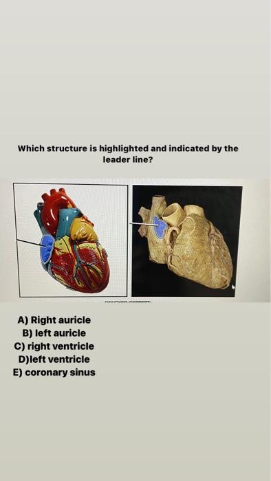 Solved What structure is highlighted and indicated by the | Chegg.com