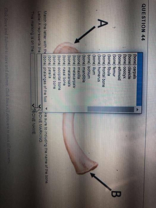Solved QUESTION 44 B A Match the letter with the bone | Chegg.com