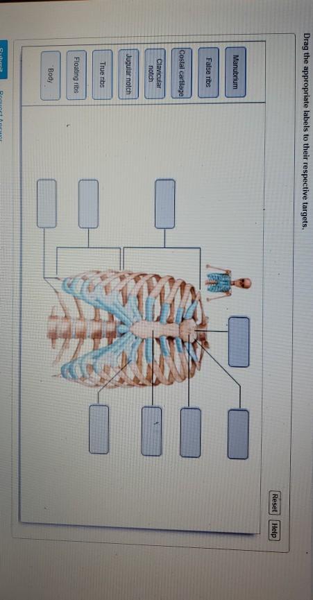 Solved What is the bone feature at A? C fovea capitis linea | Chegg.com