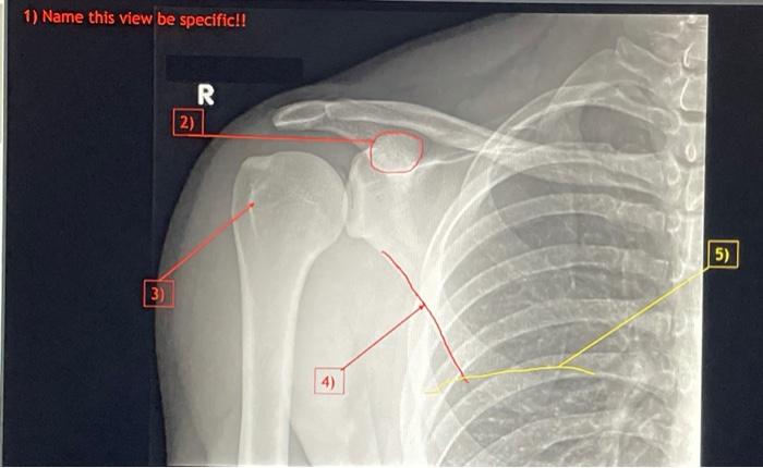 Solved 1) AP shoulder external rotation2) coracoid | Chegg.com