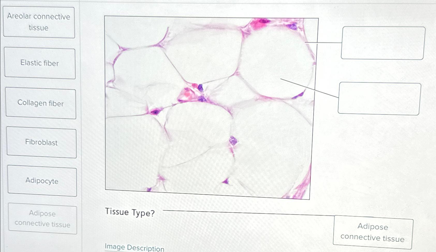 Solved AdiposeTissue Type?connective tissueImage Description | Chegg.com Solved AdiposeTissue Type?connective tissueImage Description | Chegg.com