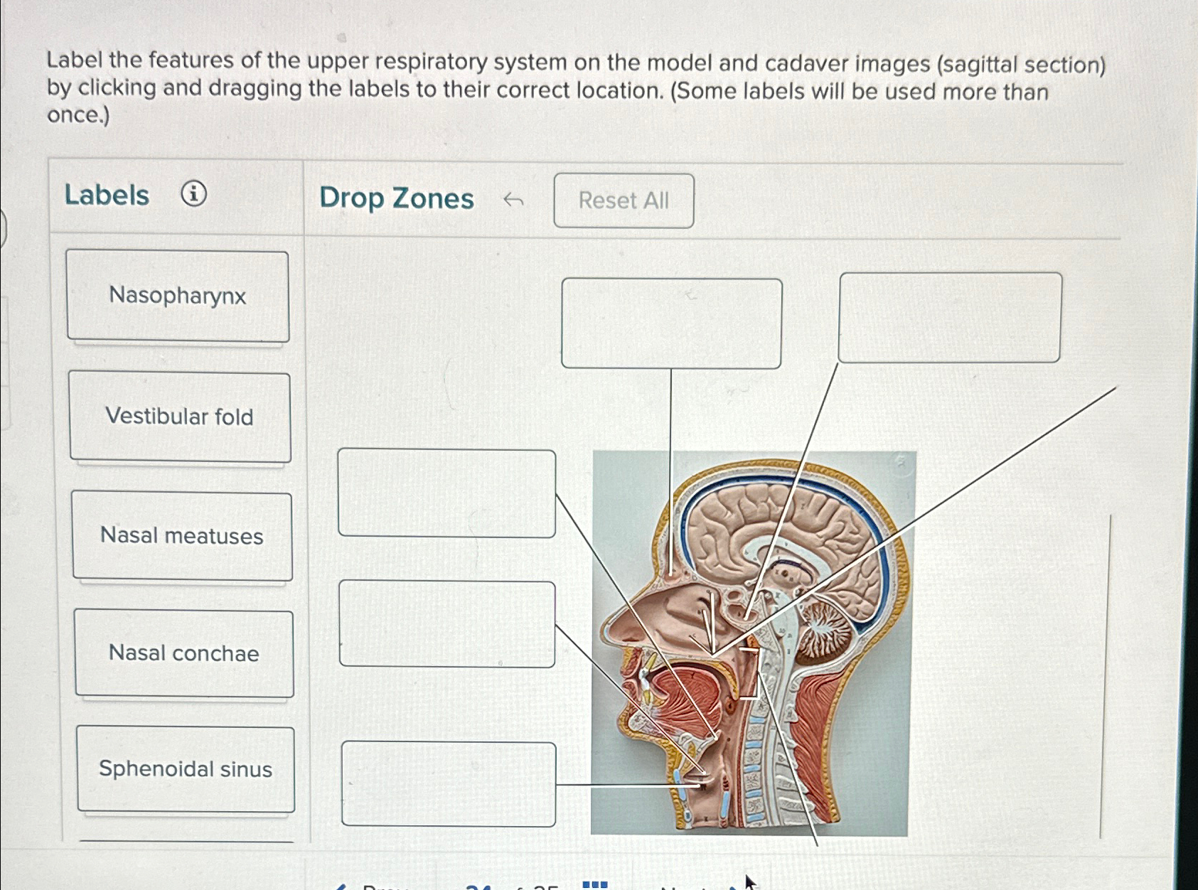 Solved Label the features of the upper respiratory system on | Chegg.com