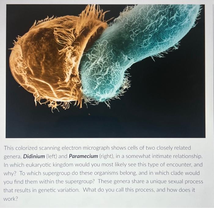 Solved This colorized scanning electron micrograph shows | Chegg.com