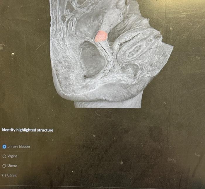 Solved Identify highlighted structure urinary bladder | Chegg.com