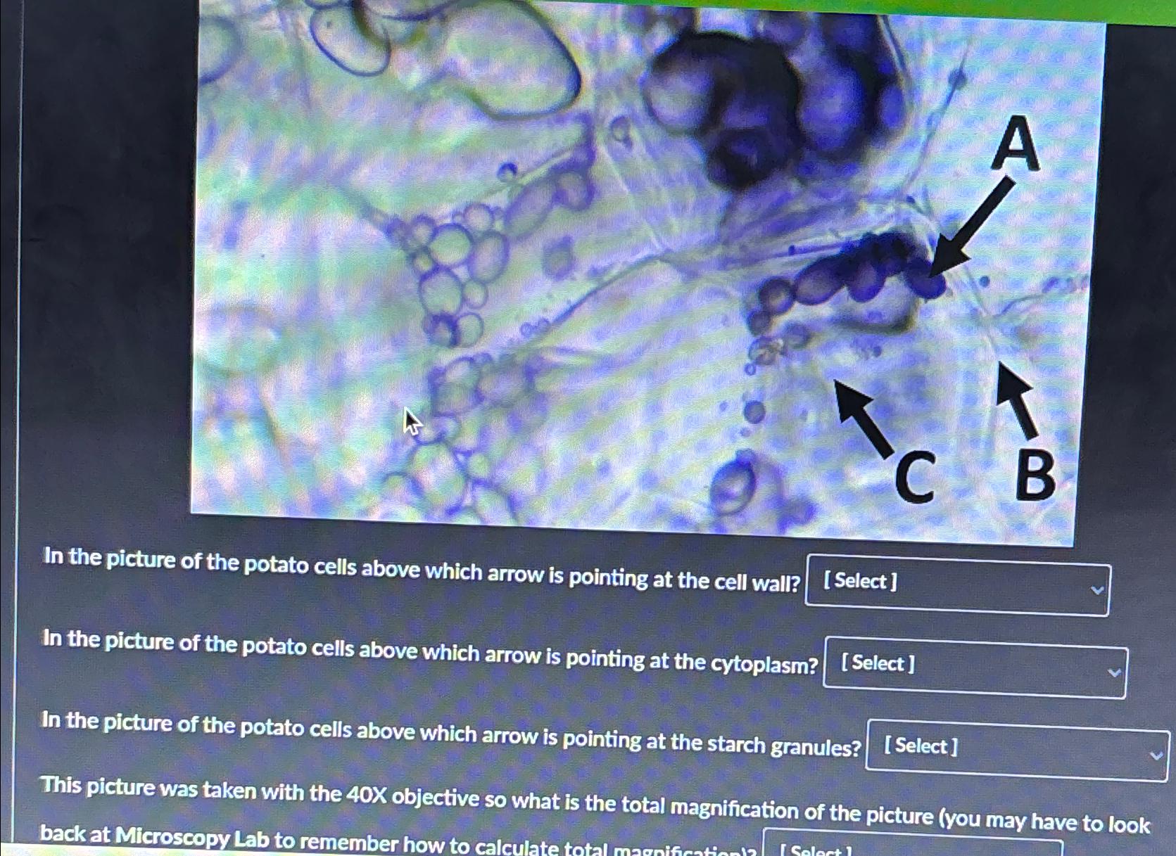 Solved In the picture of the potato cells above which arrow | Chegg.com