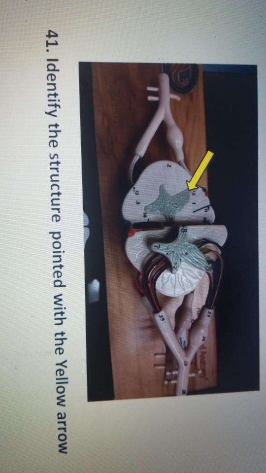 Solved 25 8 41. Identify the structure pointed with the | Chegg.com