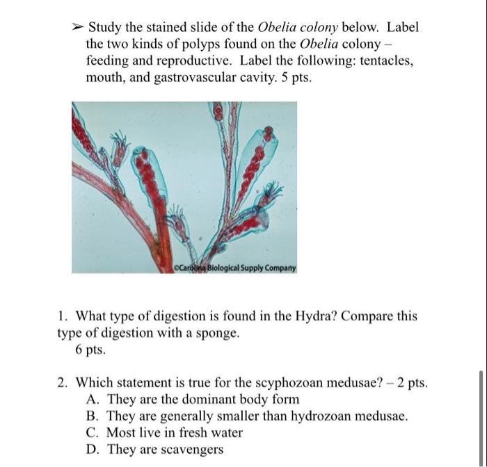 Solved > Study the stained slide of the Obelia colony below. | Chegg.com