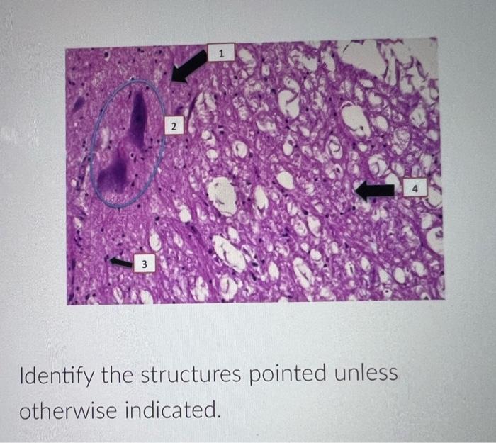 Solved 1 2 اندا 3 Identify the structures pointed unless | Chegg.com