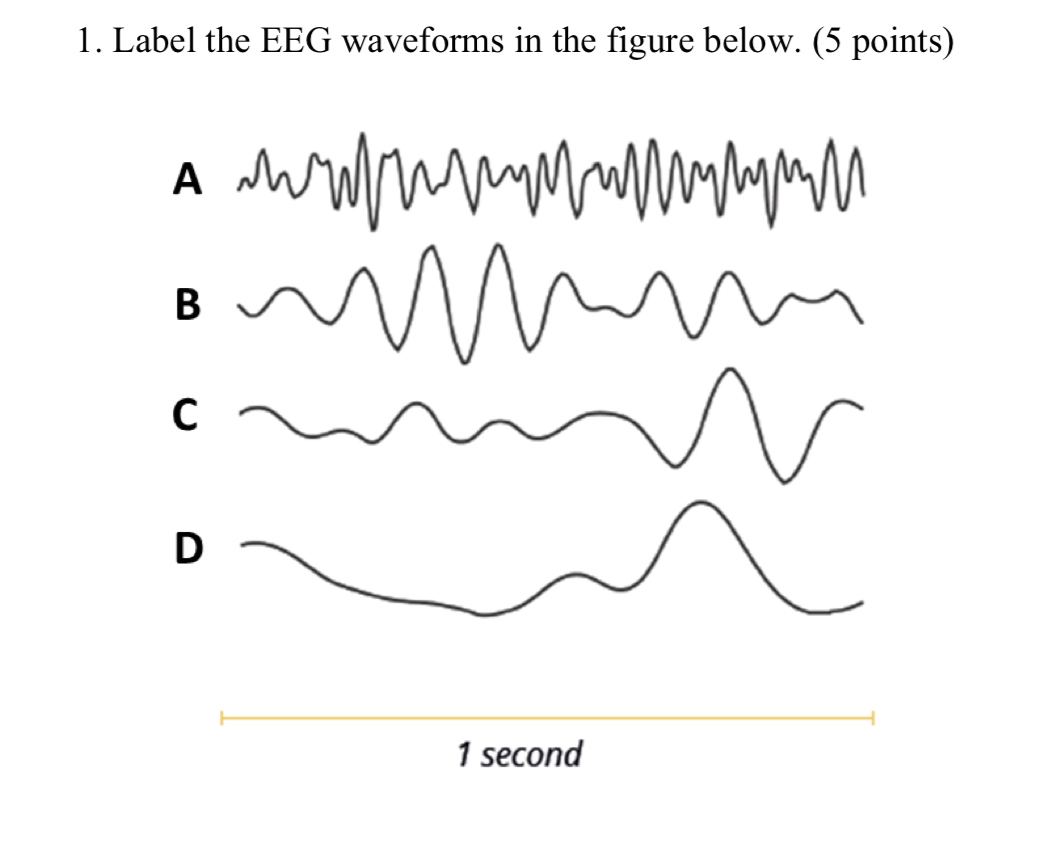Solved Label the EEG waveforms in the figure below. (5 | Chegg.com