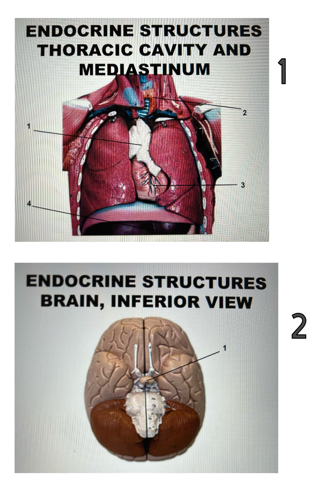 Solved ENDOCRINE STRUCTURES THORACIC CAVITY AND | Chegg.com