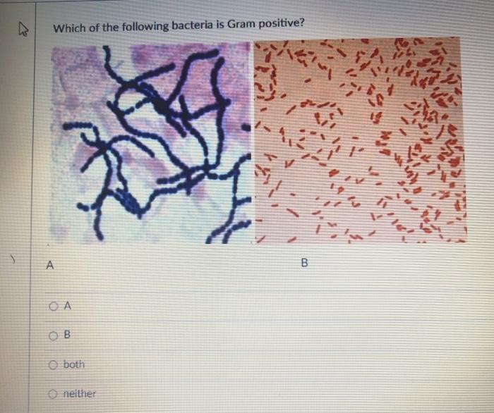 Solved A sample of Cerebral spinal fluid from a patient with | Chegg.com
