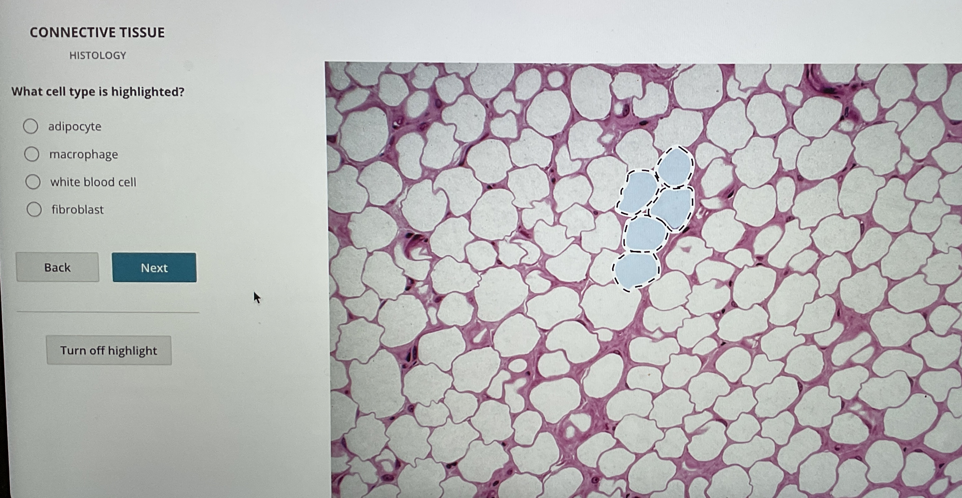 Solved CONNECTIVE TISSUEHISTOLOGYWhat cell type is | Chegg.com
