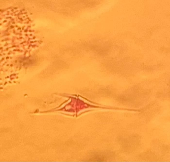 Solved ceratium noticed that the cell wall is made up of a | Chegg.com