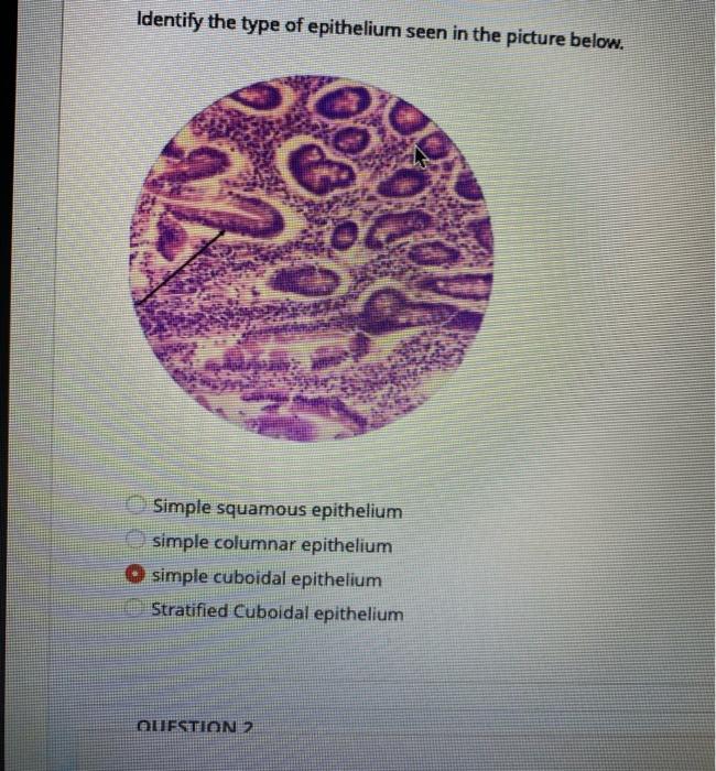 Solved Identify the type of epithelium seen in the picture | Chegg.com