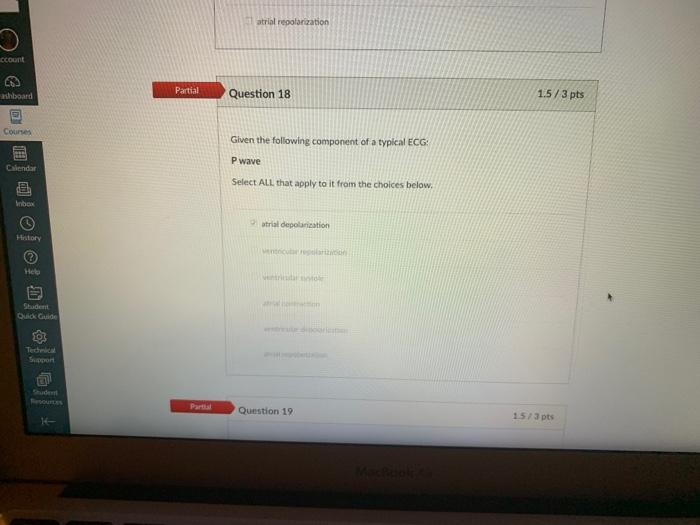 Solved Part III. Matching ECG Components to Heart Actions | Chegg.com