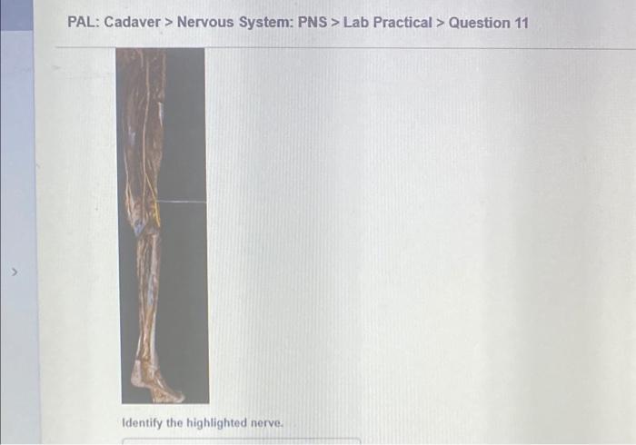 PAL: Models > Nervous System - CNS > Lab Practical > | Chegg.com