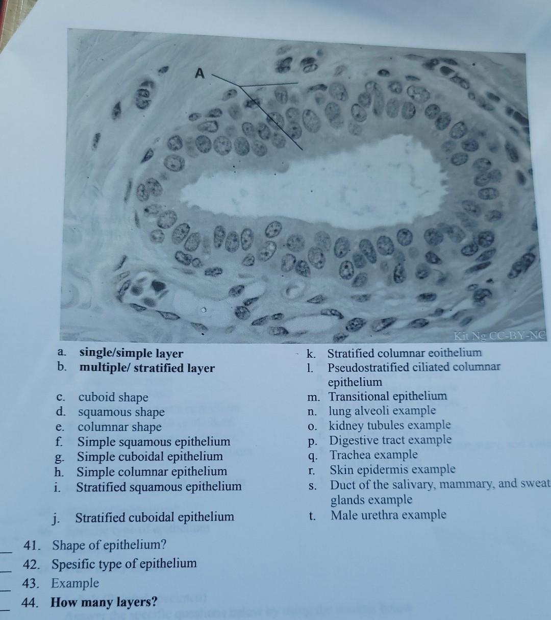Solved 41. Shape of epithelium? 42. Spesific type of | Chegg.com