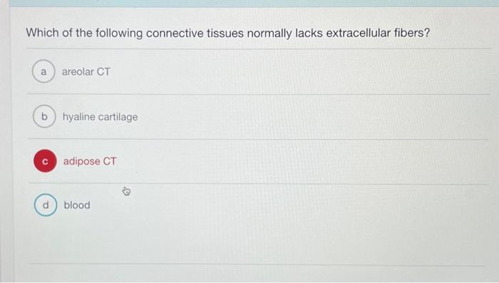 Solved Which of these is true regarding the primary union vs | Chegg.com