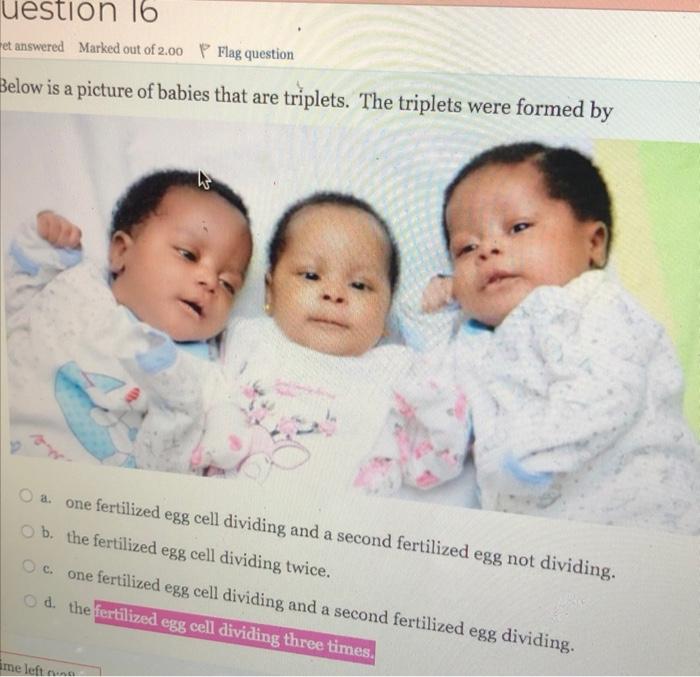 Solved selow is a picture of babies that are triplets. The | Chegg.com