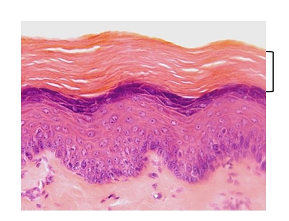 Solved What stratum is highlighted by the bracketed area? | Chegg.com