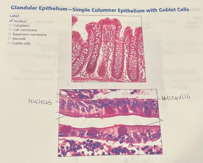 Solved Glandular Epithelium-Simple Columnar Epithelium with | Chegg.com
