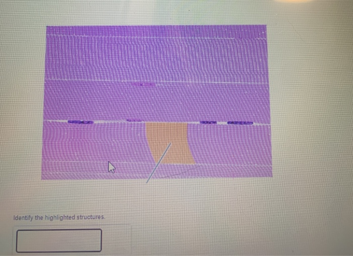 Solved Identify the highlighted structures. | Chegg.com