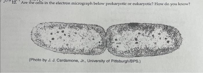 Solved 12. Are the cells in the electron micrograph below | Chegg.com