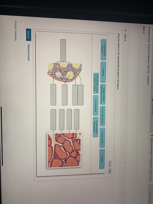 Solved Mastering andP: Assignments Endocrine sy | Chegg.com