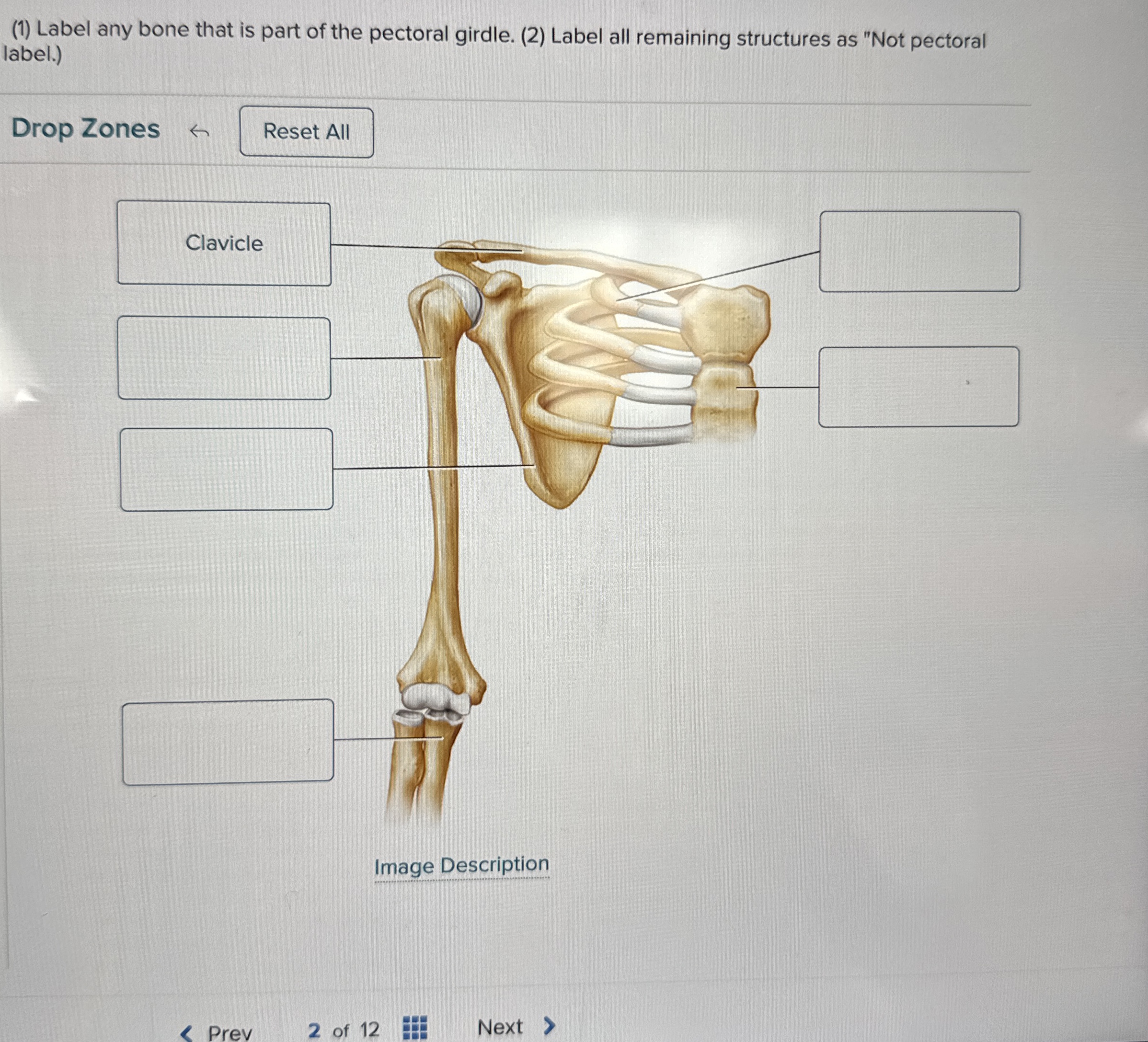 Solved (1) Label any bone that is part of the pectoral | Chegg.com Solved (1) Label any bone that is part of the pectoral | Chegg.com