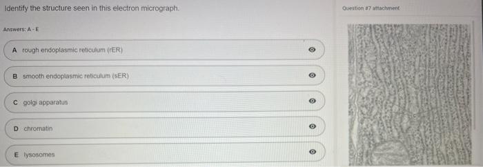 Solved Identify the structure seen in this electron | Chegg.com