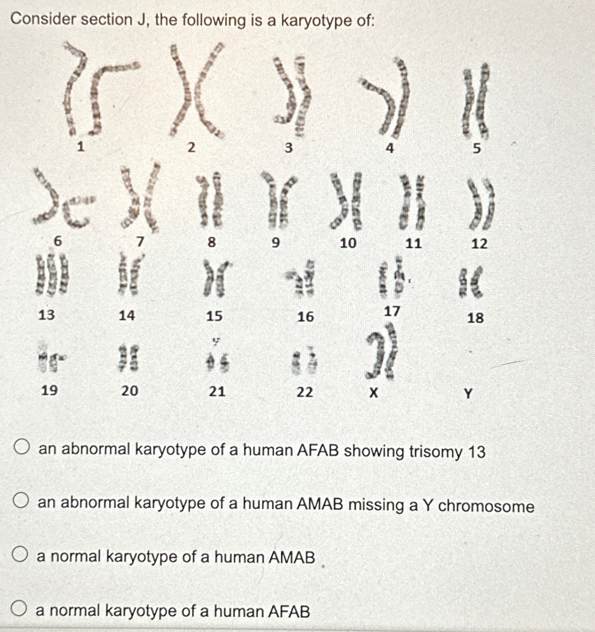 Solved Consider section J, ﻿the following is a karyotype | Chegg.com