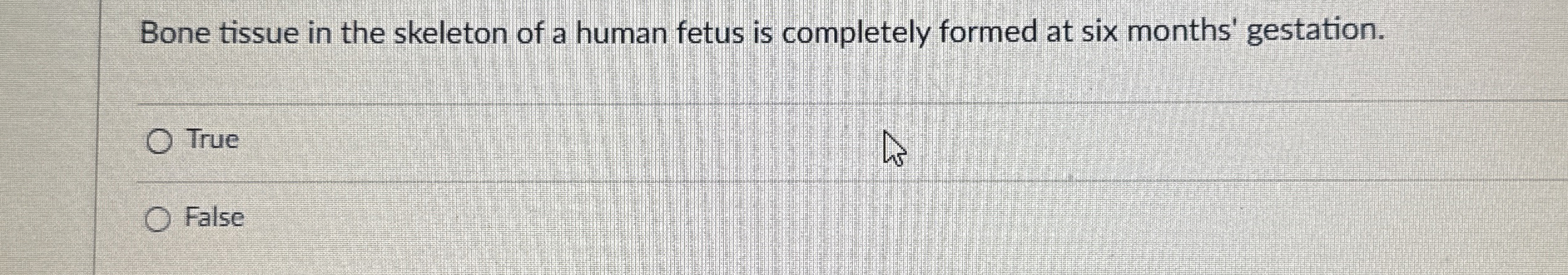 Solved Bone tissue in the skeleton of a human fetus is | Chegg.com