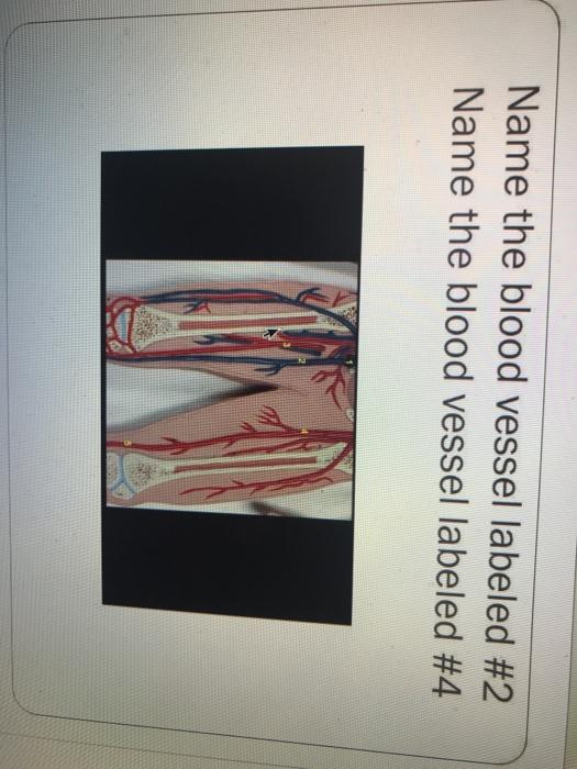 Solved Name the blood vessel labeled #2 Name the blood | Chegg.com