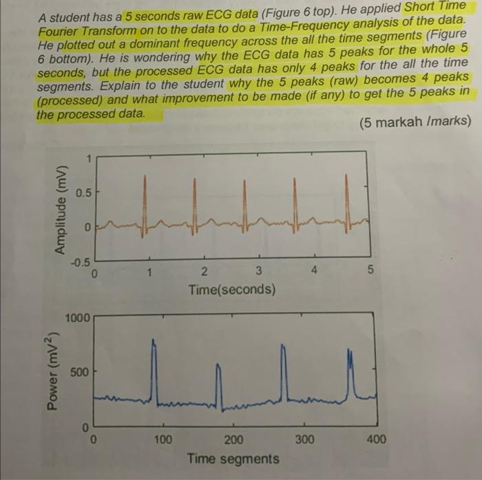 Solved A student has a 5 seconds raw ECG data (Figure 6 | Chegg.com