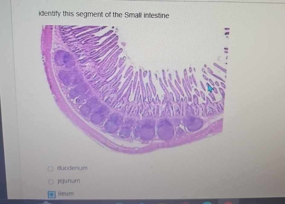 Solved identify this segment of the Small intestine | Chegg.com