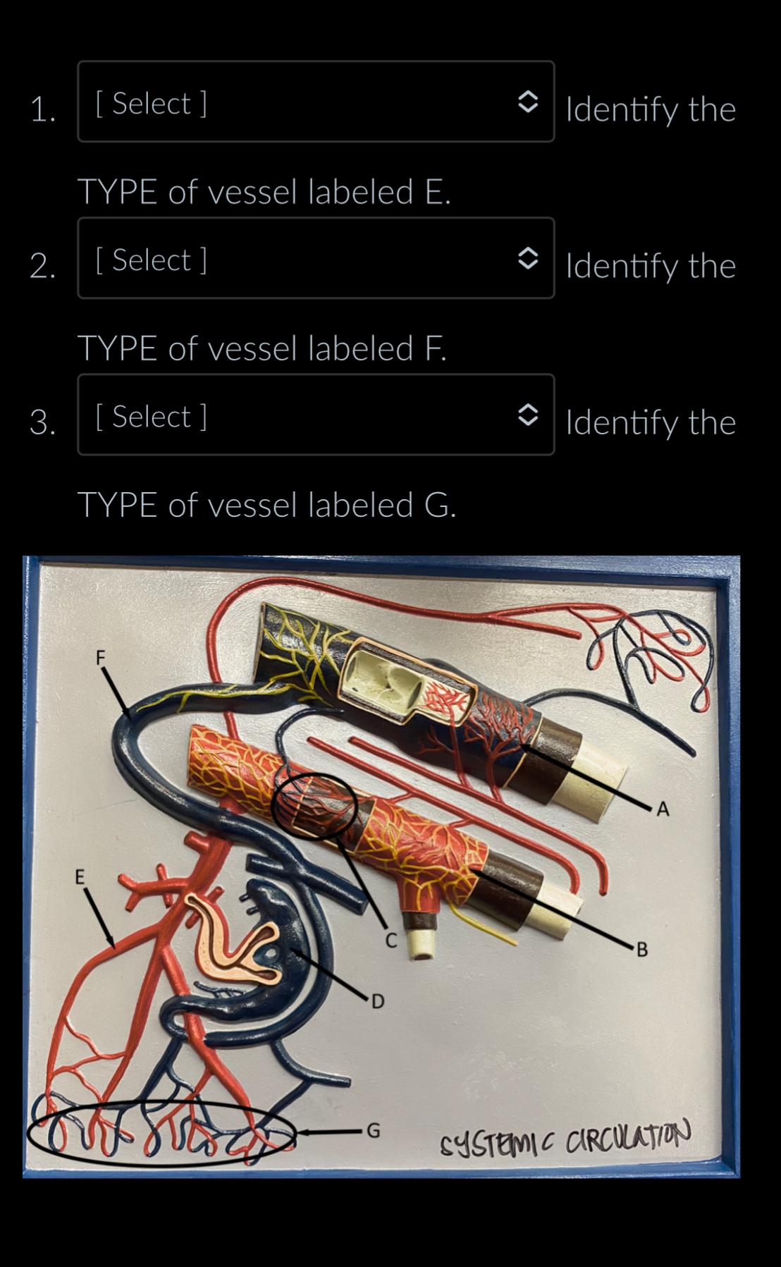 Select ]Identify theTYPE of vessel labeled E.2.[ | Chegg.com