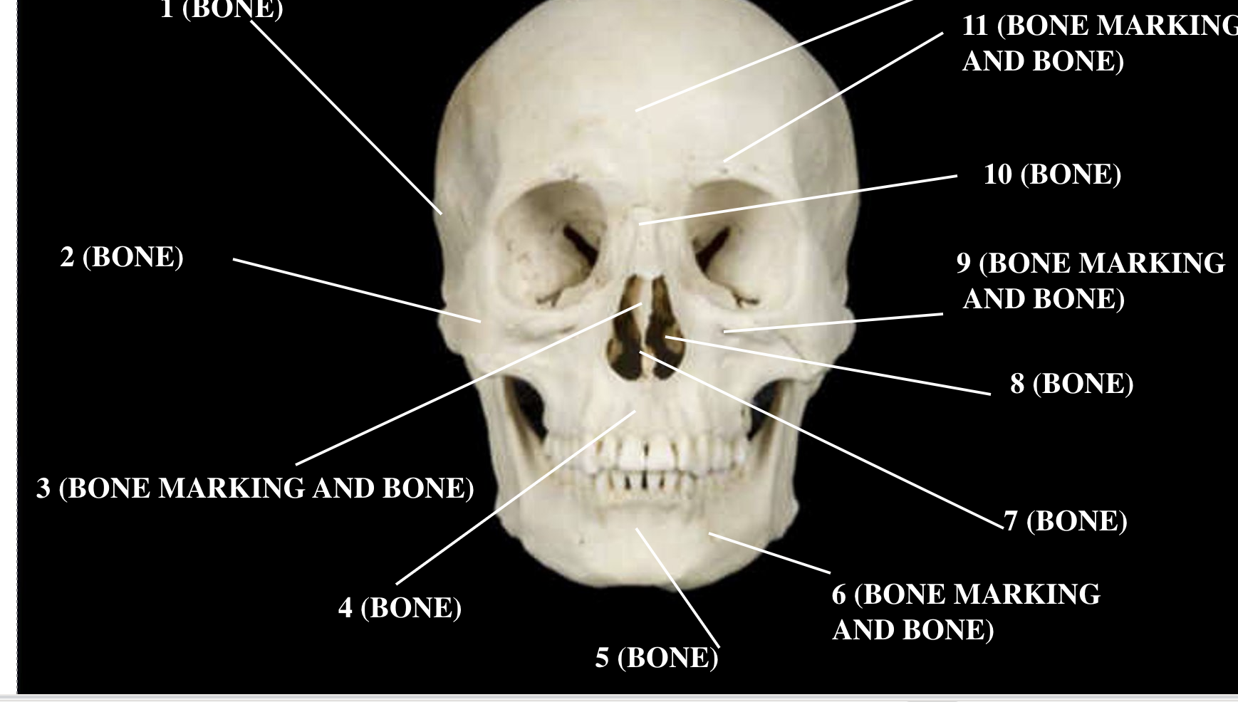 Solved what are the bones? and markings if it asks | Chegg.com